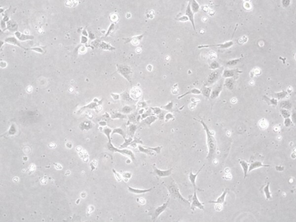 mEER Mouse E6/E7/hRas Oropharynx Epithelial Cell Line | SCC626
